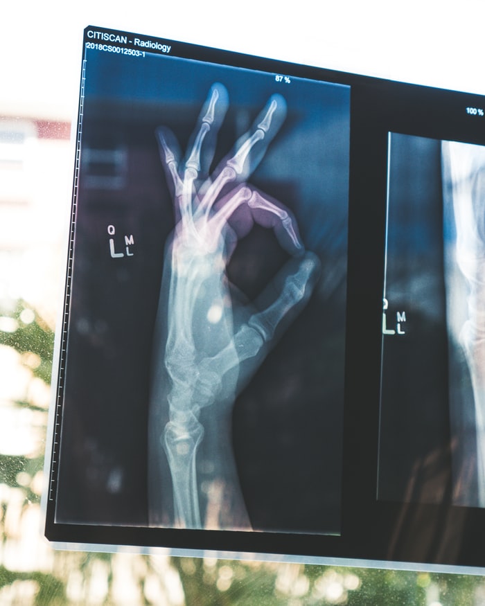 Boron: Bursitis, Bones, Brain and Other Benefits– Pure TheraPro Rx