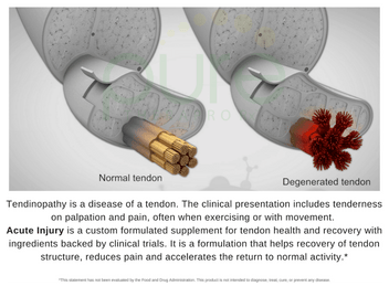 Acute Injury - 90 Capsules - Tendon and Ligament... – Pure TheraPro Rx